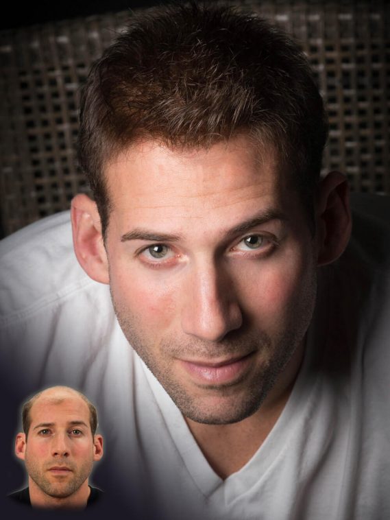 Gallery - JA Alternatives